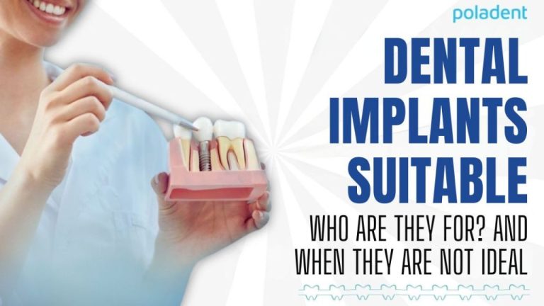 Who are dental implants suitable for and when are they not ideal? – [EN ...